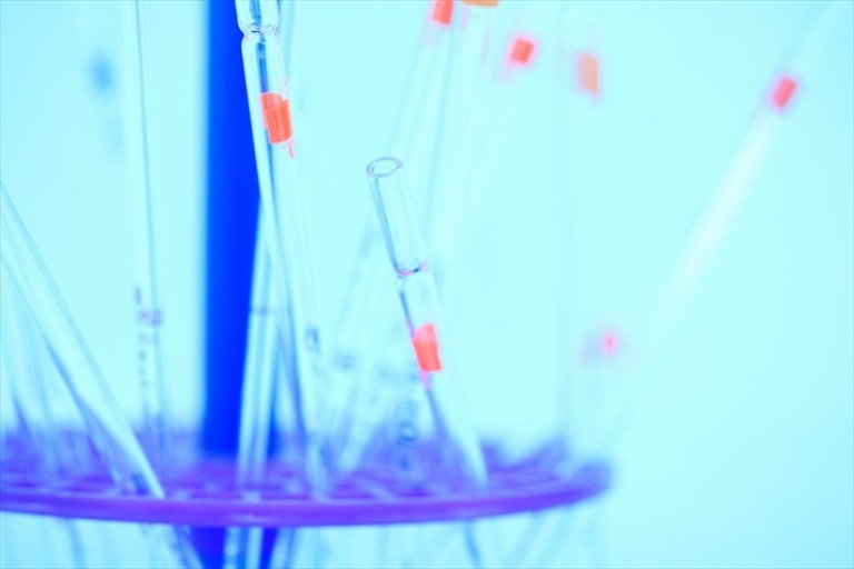 Analiza Krvi | Kompletna Krvna Slika | Tumačenje rezultata