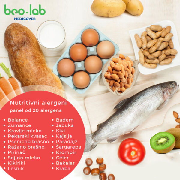 Analiza Nutritivni alergeni-panel 20 | Poruči onlajn | Beo-lab