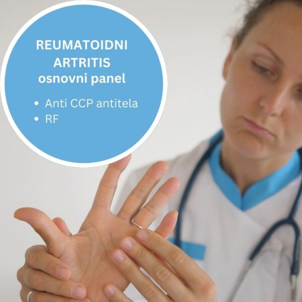 Analiza Reumatoidni artritis - osnovni panel | Poruči onlajn | Beo-lab