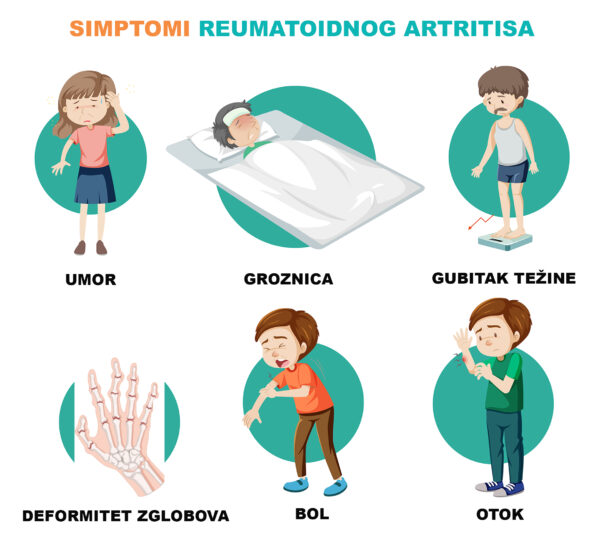 Reumatoidni artritis – simptomi, uzroci, dijagnostika i terapija - Beo ...