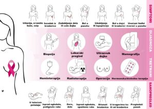 Rak dojke - dijagnostika i lečenje - Beo-lab laboratorije